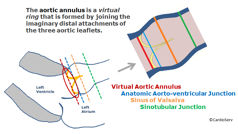 How to Master Aortic Measurements With These 5 Techniques Cardioserv