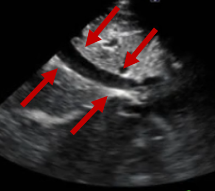 Inspiring Excellence Series: How Can I Improve This Echo Image? Cardioserv