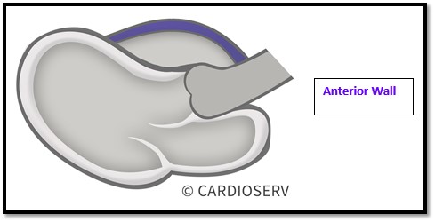 Introduction to Right Heart Assessment Cardioserv