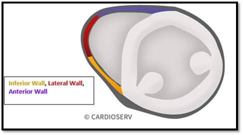 Introduction to Right Heart Assessment Cardioserv