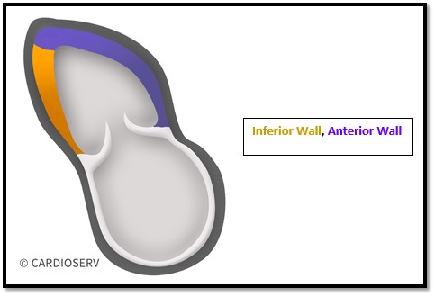 Introduction to Right Heart Assessment Cardioserv