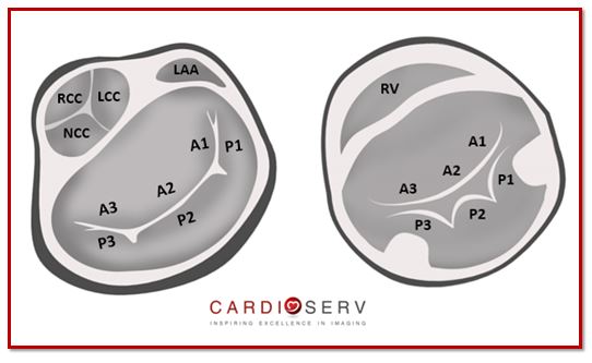 Finally... Mitral Valve Orientation Explained! Cardioserv