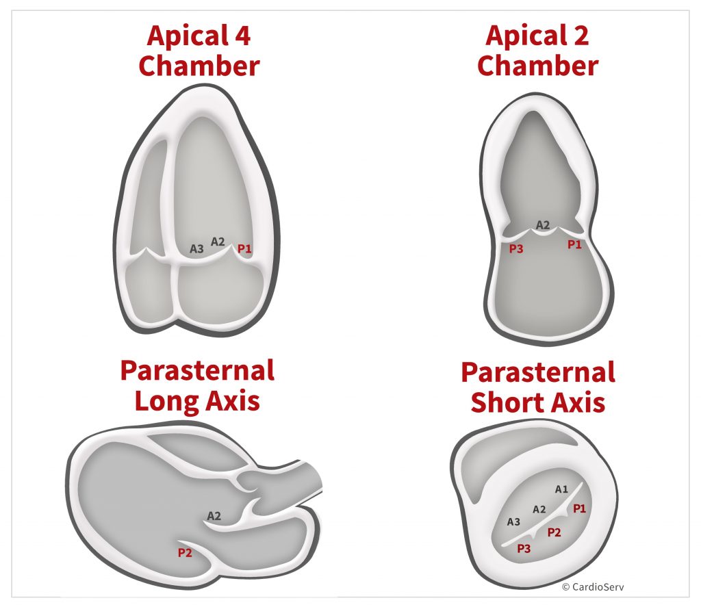 Finally... Mitral Valve Orientation Explained! Cardioserv