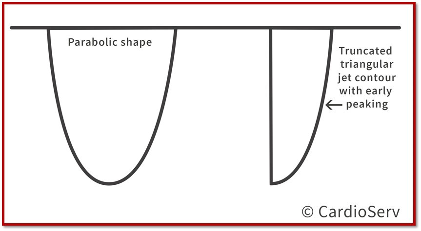 3 Doppler Techniques for Evaluation of MR! Cardioserv