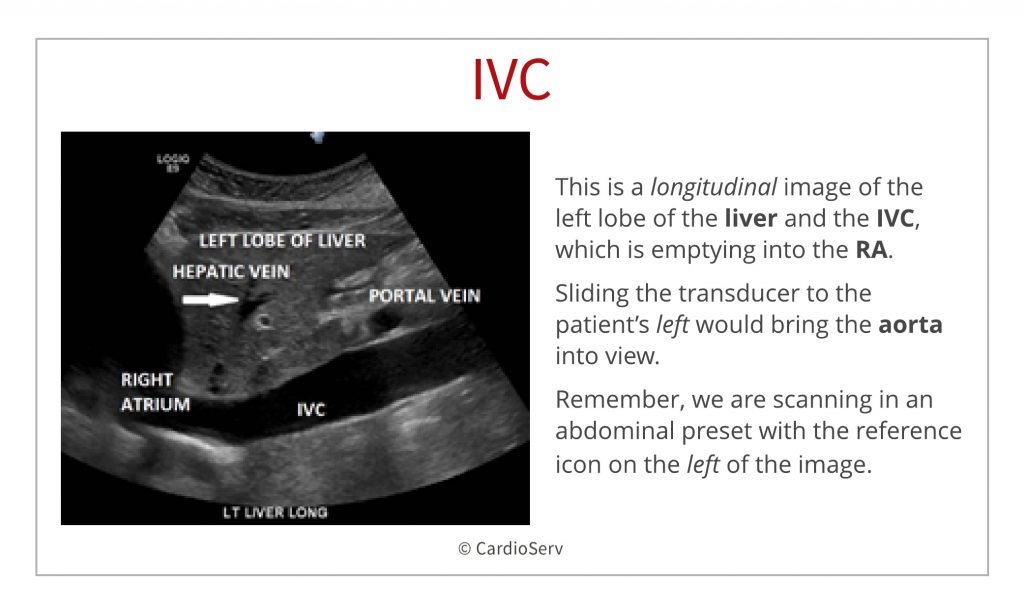 Abdominal Ultrasound for Echocardiographers: Aorta and IVC Cardioserv
